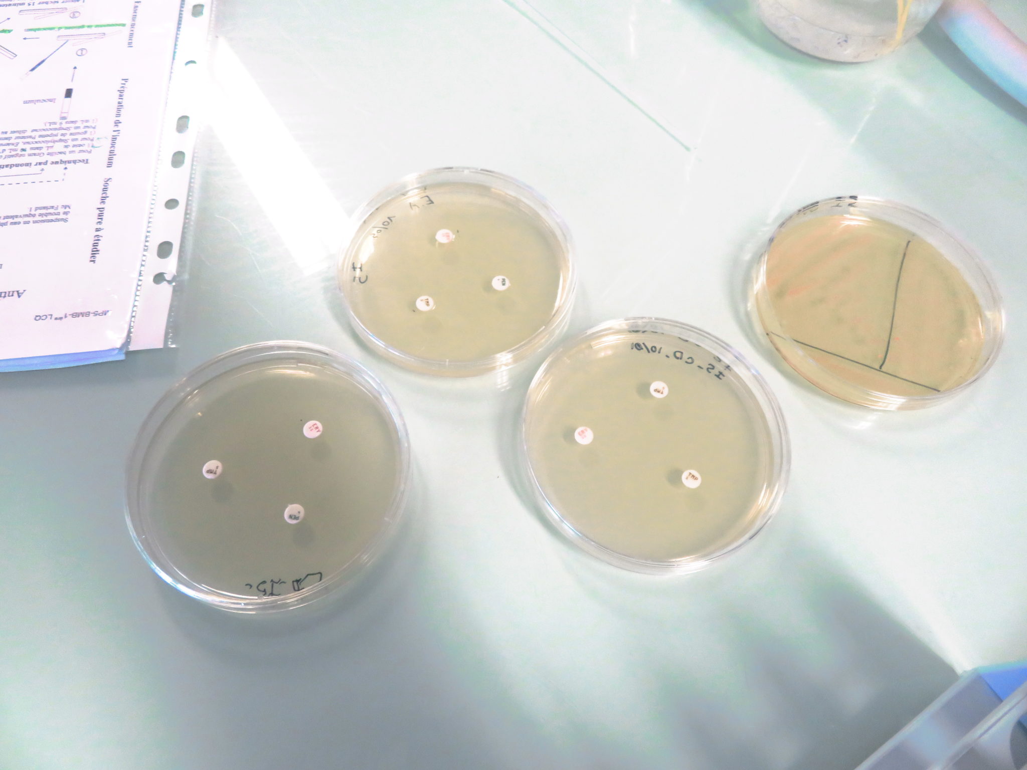 Réalisation d'un antibiogramme par les 1ères Bac Pro Laboratoire - Kerustum
