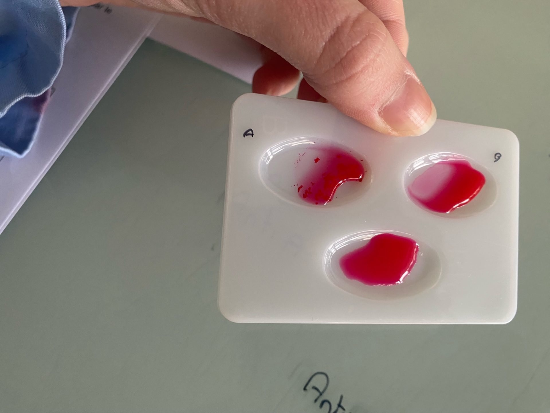 Activité groupage sanguin pour les 1ères Laboratoire - Kerustum