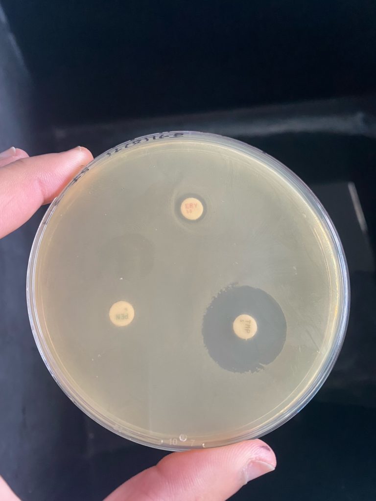 Réalisation d'un antibiogramme par les 1ères Bac Pro Laboratoire - Kerustum