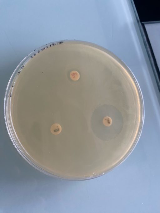 Réalisation d'un antibiogramme par les 1ères Bac Pro Laboratoire - Kerustum